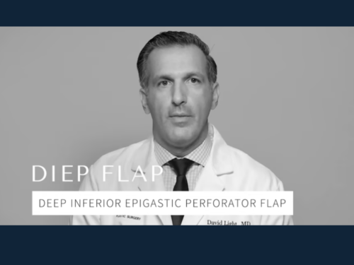 A Deep Dive Into Understanding DIEP Flap Construction - BRCAStrong